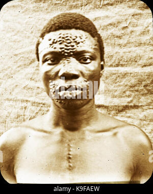 Man with scarification patterns, Congo, ca. 1900-1915 (IMP-CSCNWW33 ...