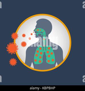 SARS logo vector icon design illustration Stock Vector Image & Art - Alamy