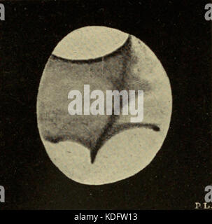 Lowell Mars (1894) Plate 15 Figure 2 Stock Photo - Alamy