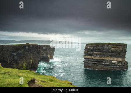 The Dun Briste Sea Stack Off The Cliffs Of Downpatrick Head In County ...