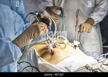Surgeons are using laparoscopy cameras inside the patient's abdominal ...