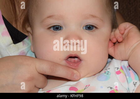 Infant with front teeth Stock Photo - Alamy