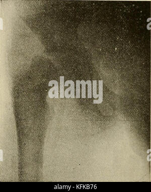 'Modern Surgery, General and Operative' (1919) discusses advancements ...