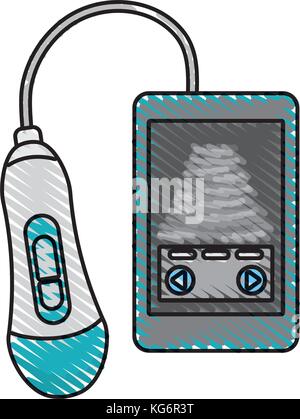 Medical equipment showing an ultrasound machine scanning device for ...
