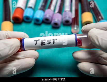 Vial To Blood Sampling, Drug Control Laboratory, Conceptual Image Stock ...