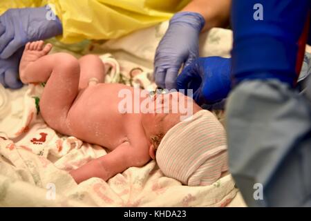 Newborn baby being checked out immediately after birth Stock Photo - Alamy