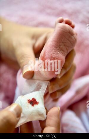 Newborn baby foot after PKU blood test Stock Photo - Alamy