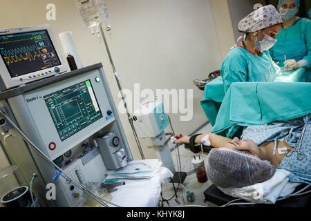Doctors perform a Cesarean section of an operating room in a maternity ...