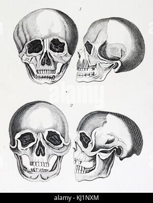 Illustration depicting the comparison of human skulls. Const. is a ...