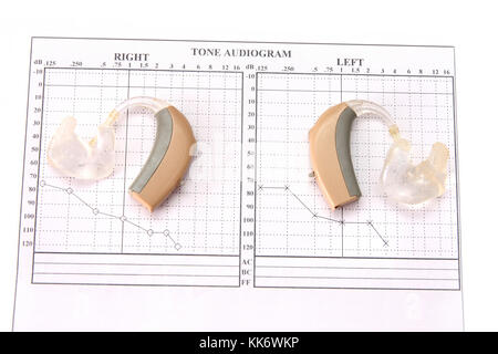 Hearing medical chart showing and hearing aid Stock Photo - Alamy