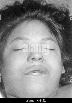 Jane Doe 1976 refers to an unidentified woman whose case became ...