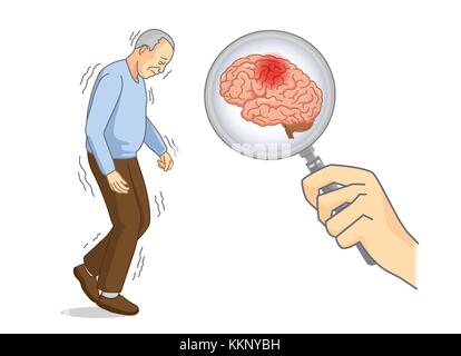 Parkinsons disease cartoon Stock Vector Image & Art - Alamy