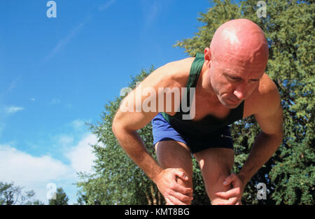Middle aged partially bald man with a head injury with twelve stitches ...