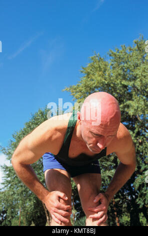 Middle aged partially bald man with a head injury with twelve stitches ...