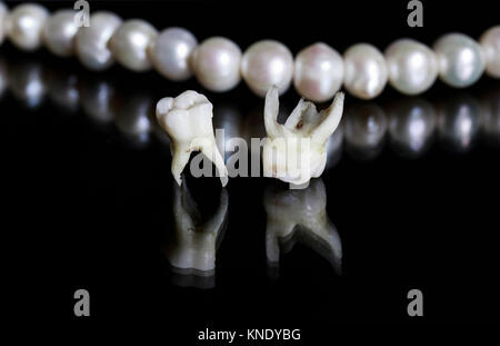 bad rotten tooth is pulled out and is located opposite the dental ...