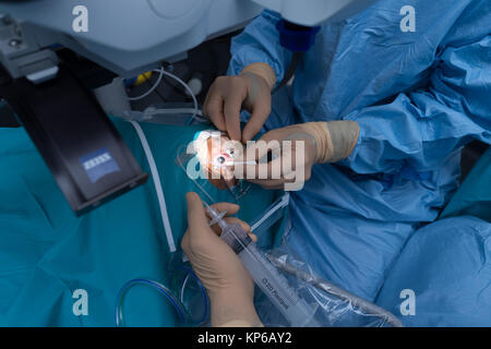 RETINAL DETACHMENT, SURGERY Stock Photo - Alamy