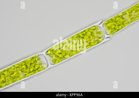 Bright field photomicrograph of filamentous algae cells with attached ...