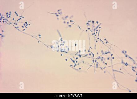 This is a photomicrograph of the fungus Microsporum gypseum using the ...