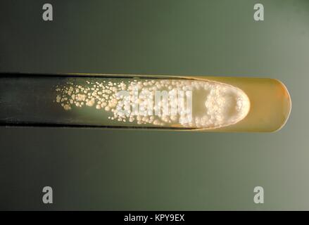 This is a SABHI agar slant culture of the fungus Sporothrix schenckii ...