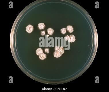 This is a plate culture of the bacteria Nocardia asteroides grown on ...
