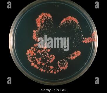 This is a plate culture of the bacteria Nocardia asteroides grown on ...