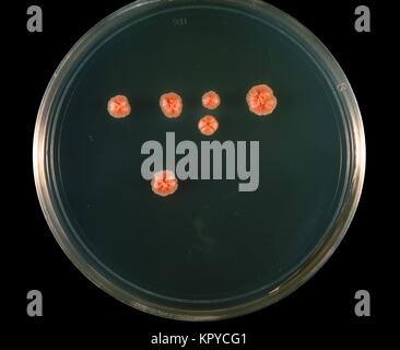 This is a plate culture of the bacteria Nocardia asteroides grown on ...