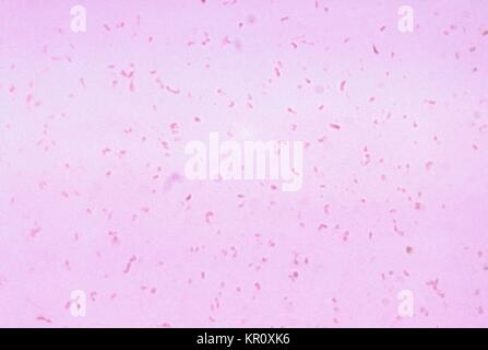 This micrograph depicts the gram-negative bacterium, Fusobacterium ...