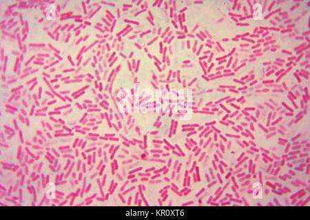 This micrograph depicts the gram-negative bacterium, Fusobacterium ...