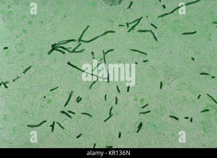 A micrograph of a pigeon brain using methenamine silver stain ...