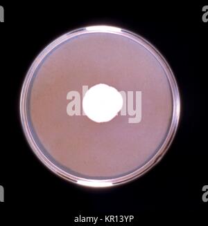 This is a plate culture of the fungus Candida albicans, strain 7H10 ...