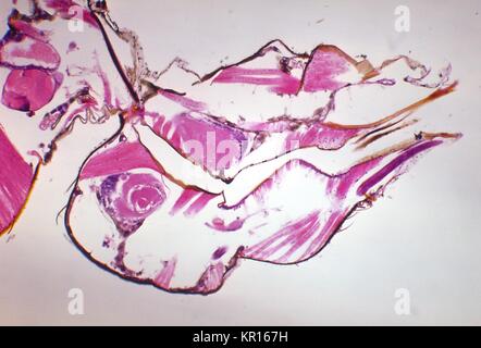 A photomicrograph revealing the histology of Onchocerca volvulus ...
