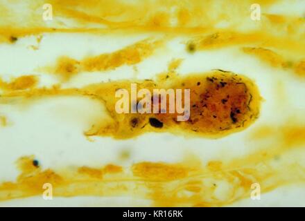 Photomicrograph of kidney tissue, using a silver staining technique ...