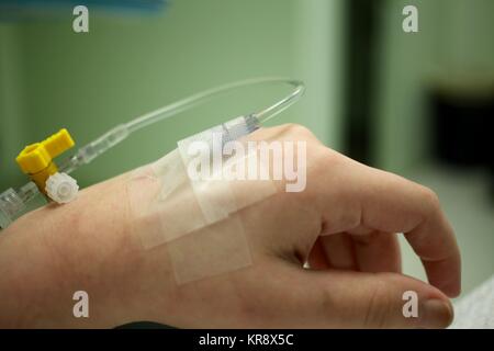 Close up of an IV needle in a patients hand Stock Photo - Alamy