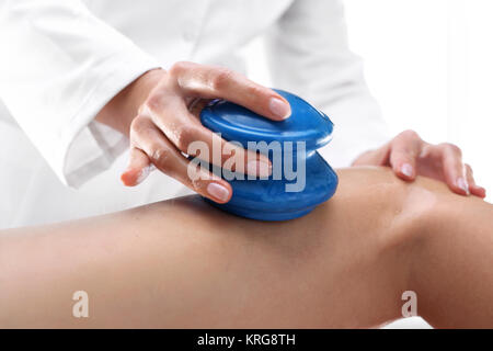 anti-cellulite massage with a chinese bulb Stock Photo - Alamy