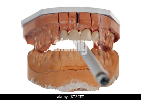 Smoking and dental health problem as a cigarette shaped as a tooth ...