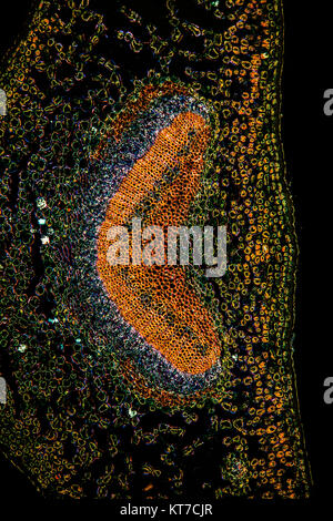 Holly leaf cross section 100x Stock Photo - Alamy