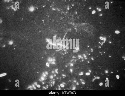 Photomicrograph of a Treponema pallidum bacterium using dark field ...