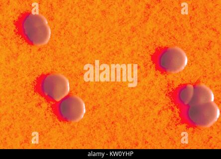 Corynebacterium diphtheriae, Colonial Growth Stock Photo - Alamy