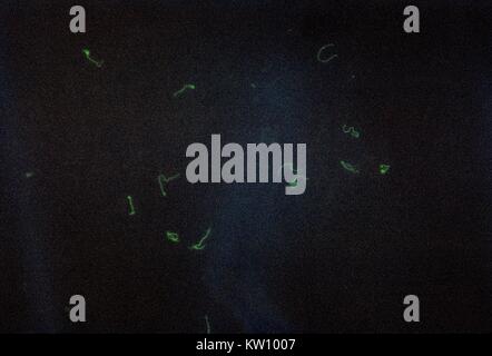 Treponema pallidum, IFA stain for Fluorescent Treponemal Antibody (FTA ...