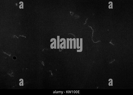 Treponema pallidum, IFA stain for Fluorescent Treponemal Antibody (FTA ...