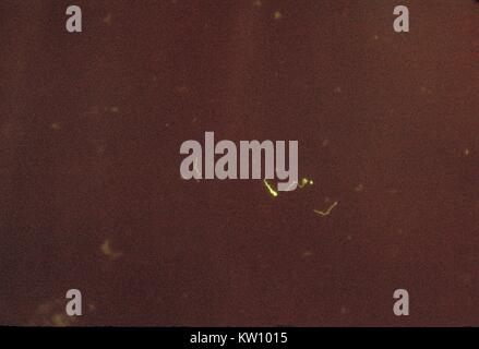 Photomicrograph of a Treponema pallidum bacterium using dark field ...