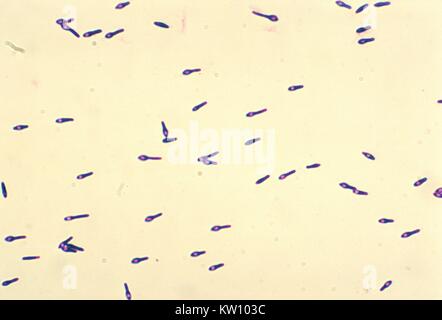 A photomicrograph of Clostridium botulinum type A viewed using a Gram ...