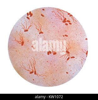 This illustration depicts a photomicrograph of Salmonella typhi ...