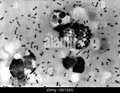 Bubonic Plague smear demonstrating the presence of Yersinia pestis ...