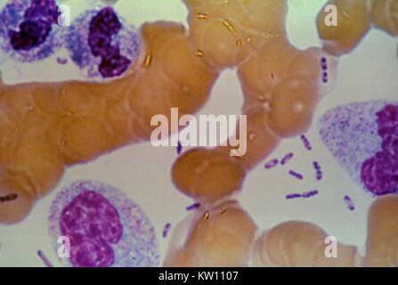 Yersinia pestis, Gram-negative bacillus, 1000x Magnification. Y. pestis ...