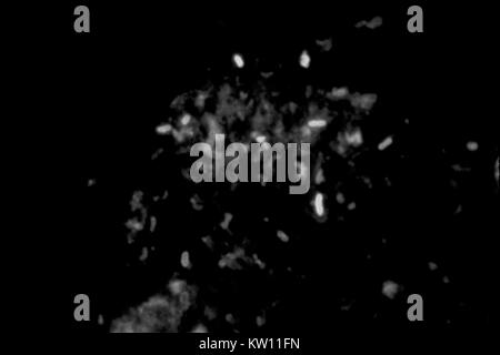 Salmonella bacteria in tetrathionate enrichment broth stained using ...