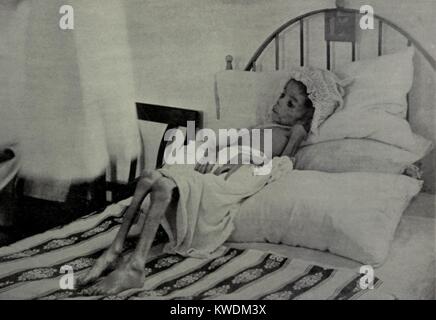 Famine during the Spanish-American war May 1898 Cuba Stock Photo - Alamy