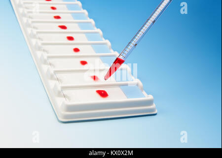 Biological assay concept. Array of blood samples for microscopy and a ...