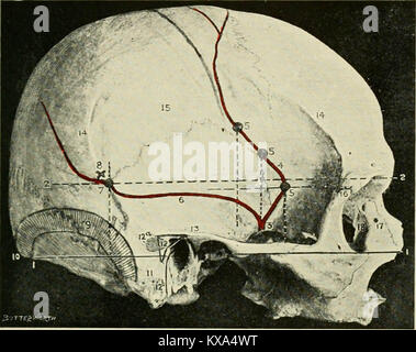 "Landmarks and surface markings of the human body" (1913 Stock Photo ...