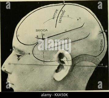"Landmarks and surface markings of the human body" (1913 Stock Photo ...
